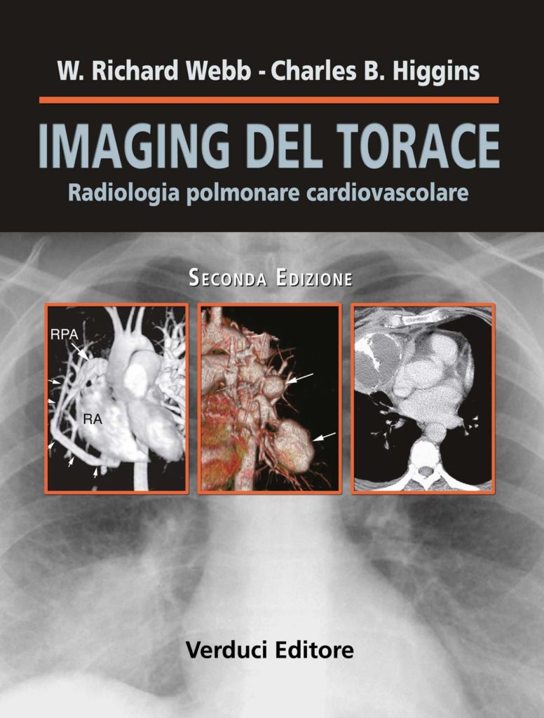 Imaging del Torace | Radiologia Polmonare e Cardiovascolare