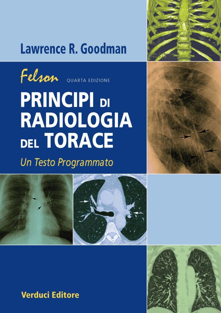 Felson - Principi di Radiologia del Torace | Verduci